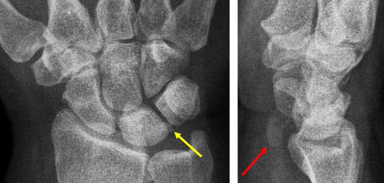 Der aktuelle Fall – MSK-Wissen